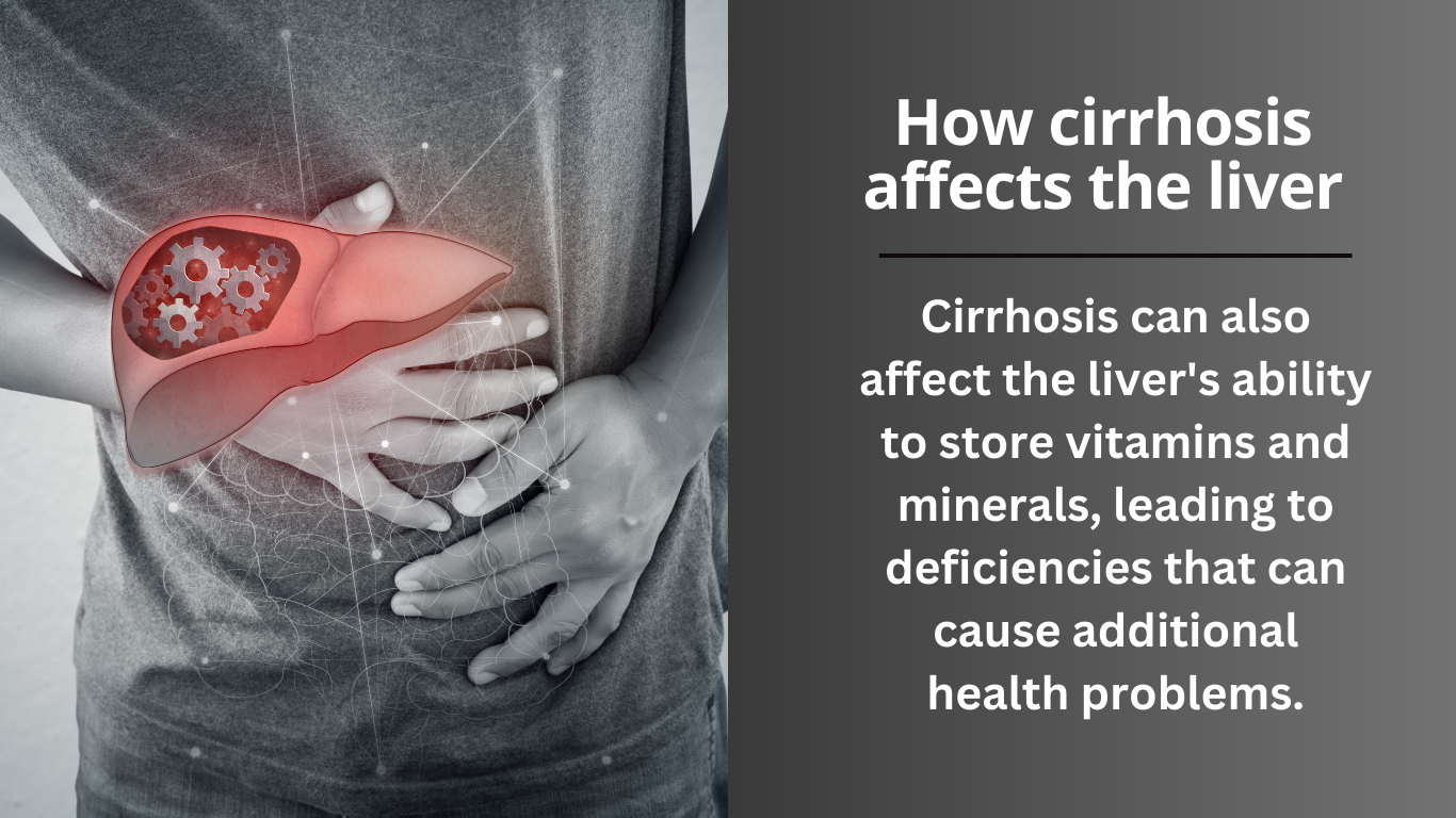 Cirrhosis and It’s Effect on the Body – Gay in the CLE