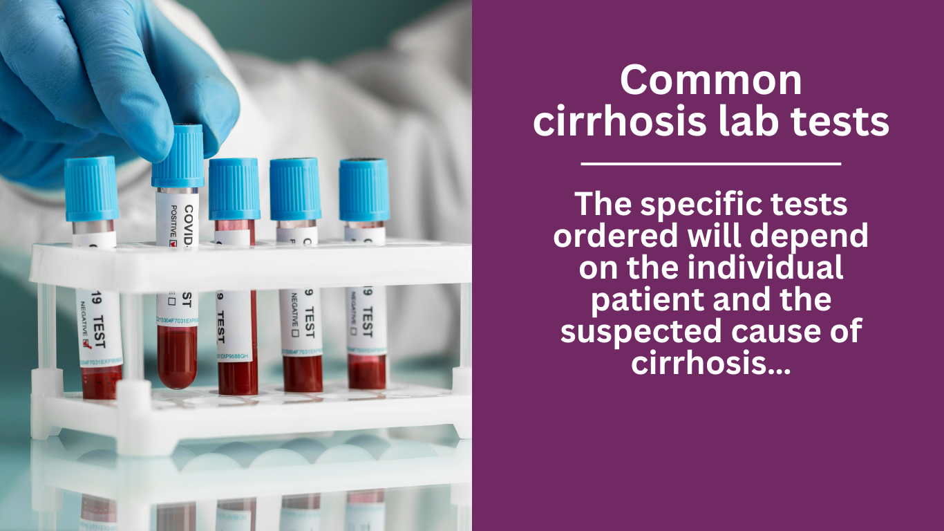 Interpreting Common Cirrhosis Lab Tests – Gay in the CLE