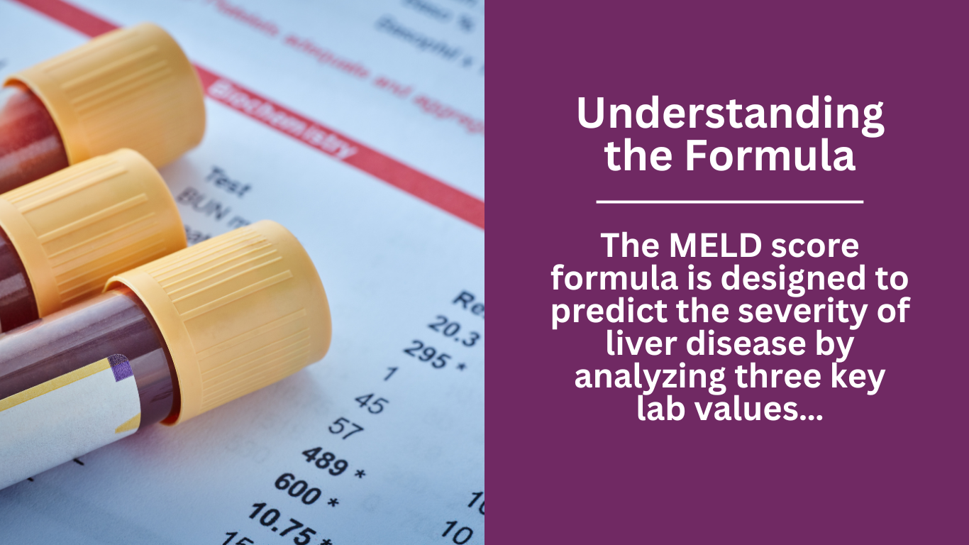 MELD Score: Understanding and How to Improve It – Gay in the CLE