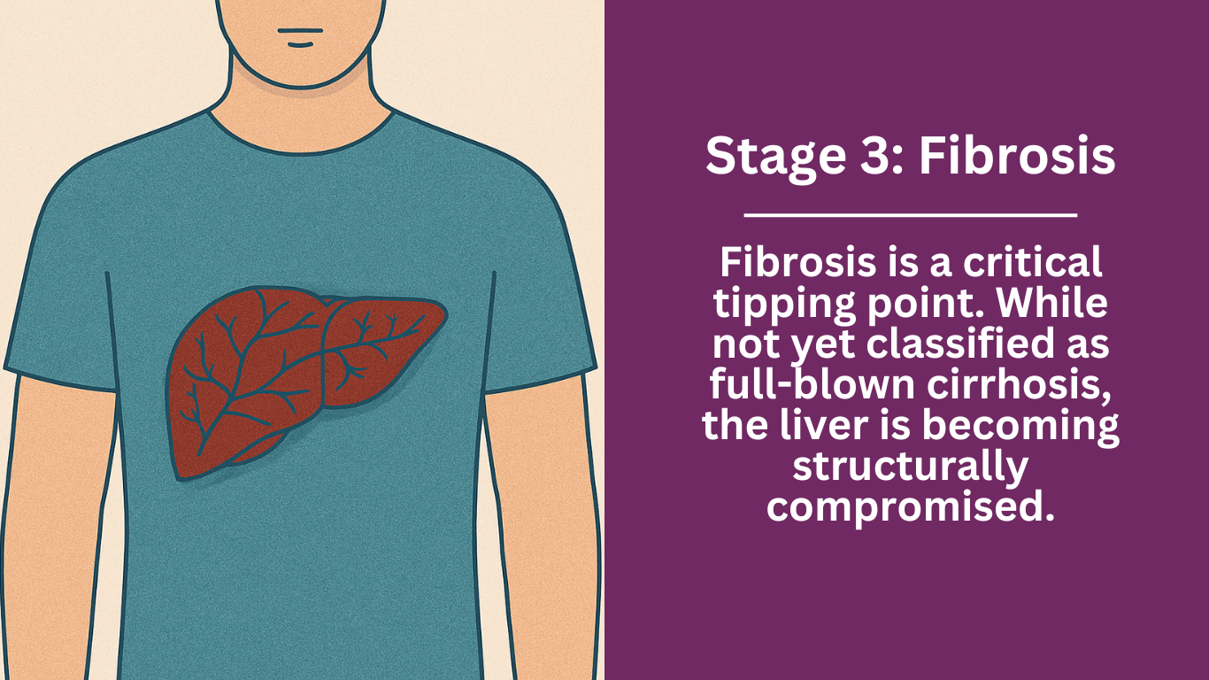 Understanding the Stages of Cirrhosis: From Fatty Liver to Liver ...